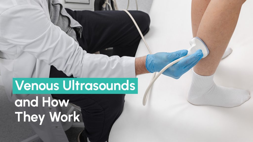 Venous Ultrasound: What It Detects and When It’s Needed